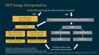 OCT INTERPRETATION Pptx
