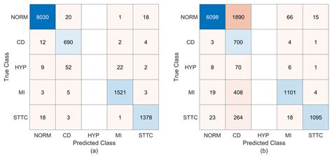 Automated Ecg Arrhythmia Classification Using Feature Images With Common Matrix Approach Based