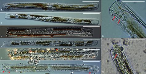 Light Micrographs Of Ectrogella Bacillariacearum At Different