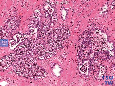 前列腺及精囊腺 天山医学院