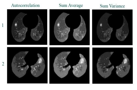 Selected Texture Features Download Scientific Diagram