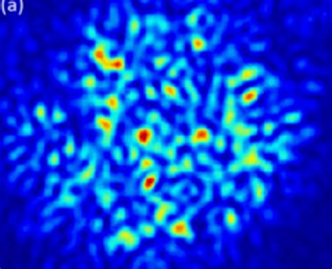 Speckle Pattern From Figure 2 Of 1 Download Scientific Diagram
