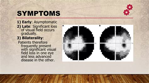 Primary Open Angle Glaucoma Pptx Eye And Vision Conditions Diseases And Conditions