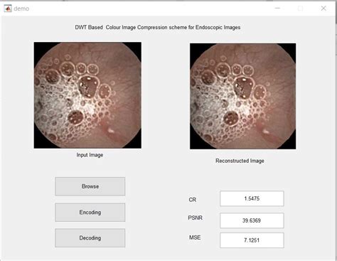 matlab code for colour image compression image processing project