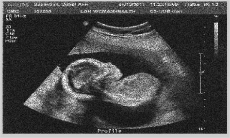 Noisy Image With Noise Variance 0 06 Download Scientific Diagram