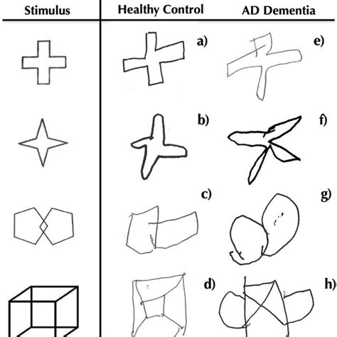 Examples Of Common Error Types In Visuoconstructional Tests In Healthy