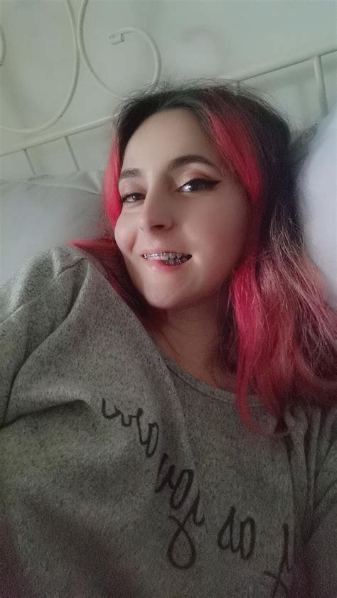 565 Best R Amature Braces Images On Pholder Ok But Like Do U Wanna Kiss Me Or Suck My Toes