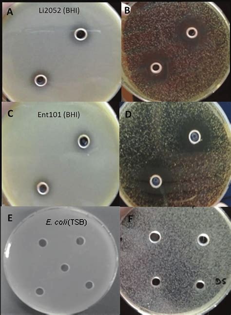 Antimicrobial Activity Of Bacteriocin Extract Produced By Pediococcus