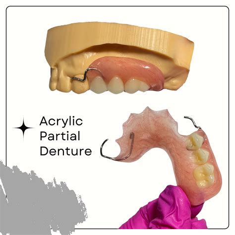 Buy Affordable Acrylic Partial Dentures Online Replace Missing Teeth