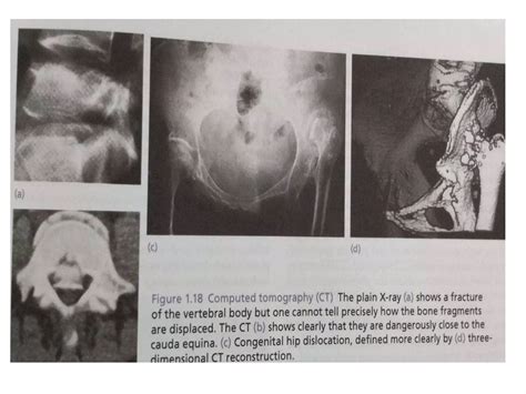 Imaging In Orthopaedics Ppt