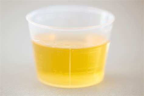 Drinking Your Own Pee Is Probably Not Helpful Health Wise Teen Vogue