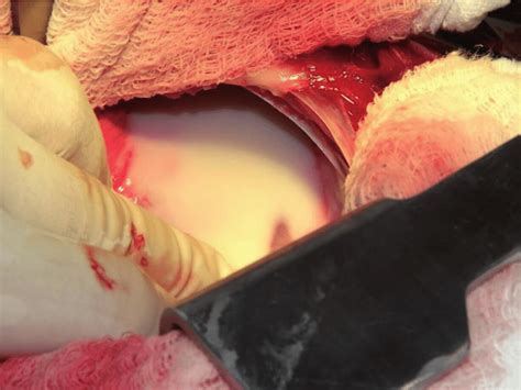 Chylothorax In A Dog Visualization Of Chylous Effusion After