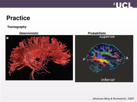 Ppt Diffusion Tensor Imaging Powerpoint Presentation Free Download