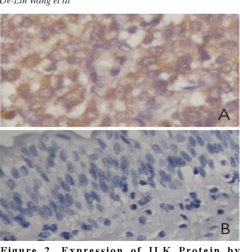 Figure 2 From Research Communication Integrin Linked Kinase Functions As A Tumor Promoter In