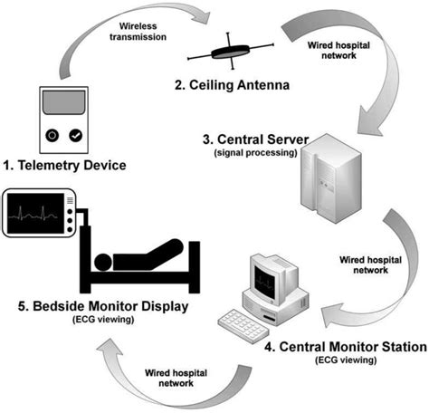 Snehlata Sharma On Linkedin Ecgtelemetrydevices Ecg