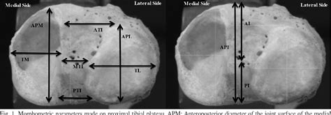 Figure 1 From Determination Of Sex Based On The Morphometric Evaluation