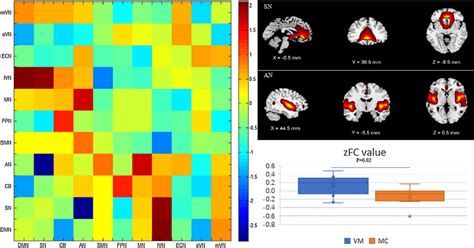 Comparison Of Differences Between Inter Network Functional Connectivity