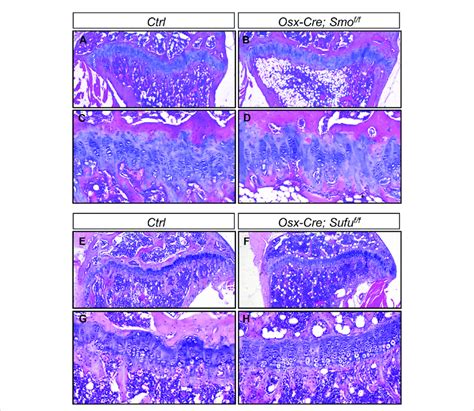 osx cre mediated ablation of either smo or sufu in hypertrophic