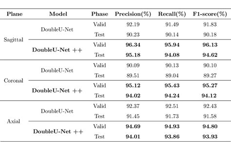 Doubleu Net Architecture With Exploit Multiscale Features For Vertebrae Segmentation Paper