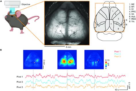 Wide Field Calcium Imaging In The Transgenic Mouse With A Broad Download Scientific Diagram