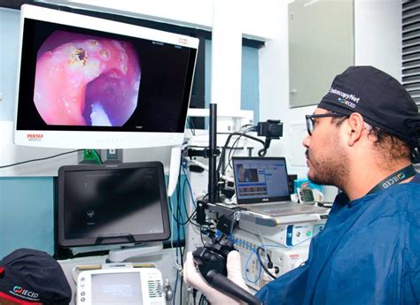 Endoscopía Terapéutica Coagulación Con Plasma Argón Endoscopynet