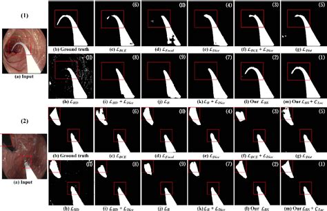 Figure 1 From Boundary Sensitive Loss Function With Location Constraint For Hard Region