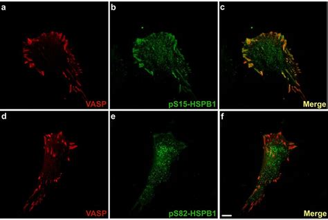 Assessment Of Focal Adhesion Localization Of Serine 15 And Serine 82