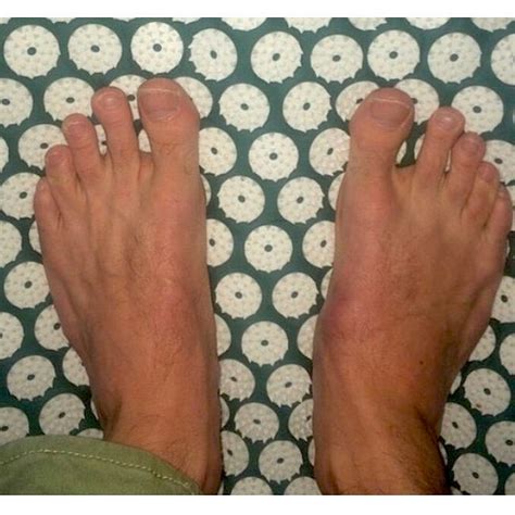 Matthew Korklans Feet