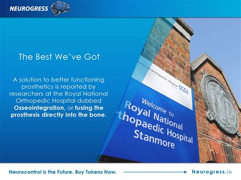 Revolutionary Mind Controlled Prosthetic Limbs