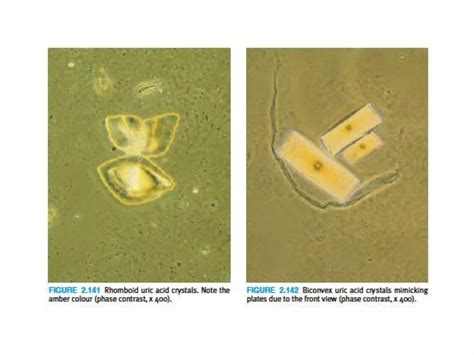 Urine Microscopy Ppt