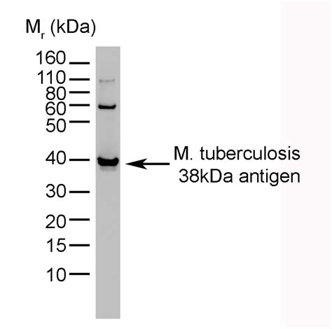 Anti Mycobacterium Tuberculosis 38kda Antigen Antibody Clone Bgn12093875 Bio Rad