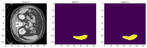 Aiml 06 Pytorch And Monai For Ai Healthcare Imaging Python Machine
