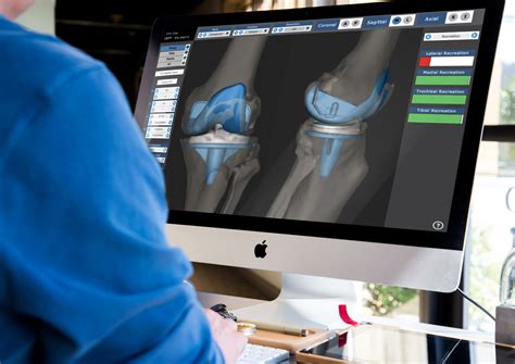 360 computer vision navigation surgical system good design