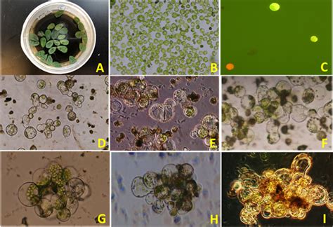 Optimization Of Isolation And Culture Of Protoplasts In Alfalfa