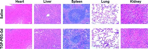 T 1 Weighted Mrct Dual Modality Imaging Guided Photothermal Therapy