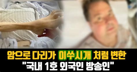 희귀암 투병으로 다리가 이쑤시개처럼 변한 국내 1호 외국인 방송인 그의 안타까운 근황을 확인해 보세요