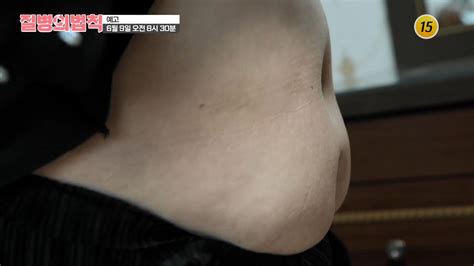 찬란한 제 의 삶을 펼친 그녀들의 이야기 질병의 법칙 회 예고 TV CHOSUN 방송 YouTube