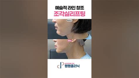 이중턱 실리프팅 조각처럼 만들어드립니다 Youtube