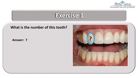 Teeth Nomenclature Numbering Surfaces And Angles Pptx