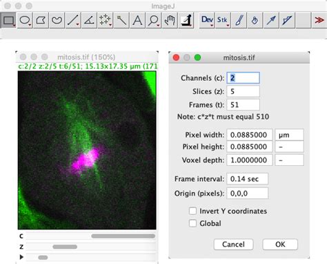 ImageJ Pixel Size Dimensions Introduction To Bioimage Analysis