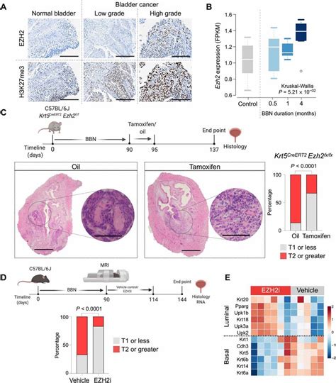Ezh2 And Its Catalytic Function Promote Higher Bca Stages A