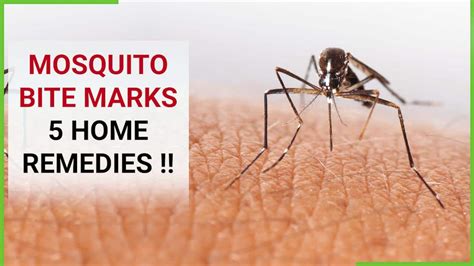 Mosquito Bite Prevention How To Get Rid Of Red Marks And Itch Effective