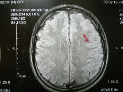 What Are The Functions Of These Parts Of The Brain Mri Medical Sciences Stack Exchange