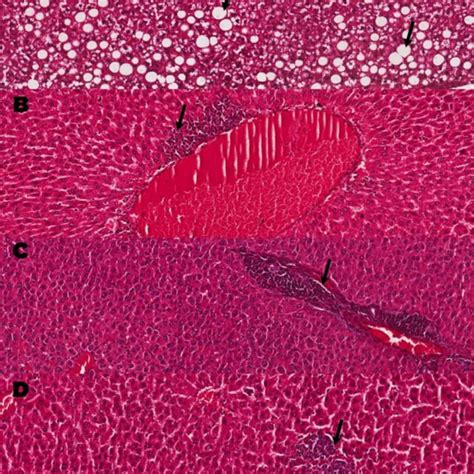 Microscope Images 10× Magnification Scale Bar 300 μm Of Liver Download Scientific Diagram