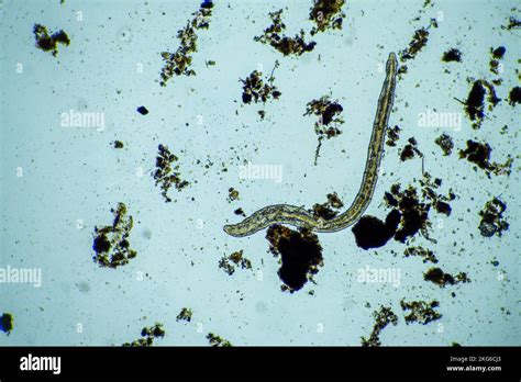 Human Parasite Gut Intestinal Infection Disease Microorganism