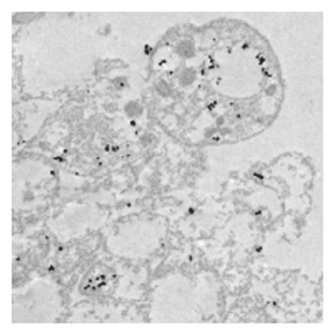 Silver Enhancement Preembedding Using Immunoelectron Microscopy In