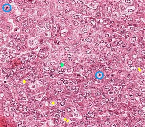 Mitosis Detection Framework Results Download High Quality Scientific