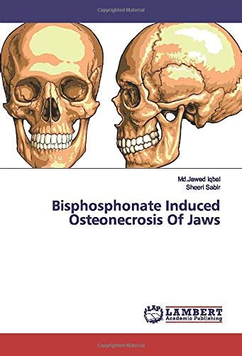 Bisphosphonate Induced Osteonecrosis Of Jaws By Mdjawed Iqbal Goodreads