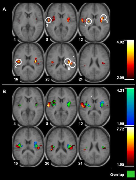 a effect 1 of interaction of presentation rate and semantic