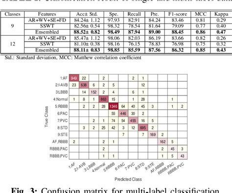 figure 3 from ensembled feature based multi label ecg arrhythmia